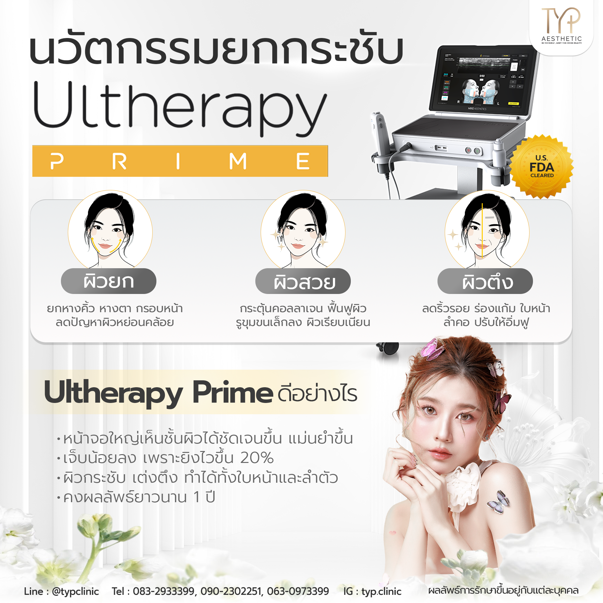 Ultherapy Prime